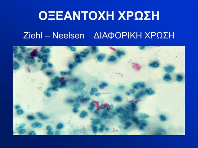 ΜΙΚΡΟΣΚΟΠΗΣΗ – ΠΑΡΑΣΚΕΥΑΣΜΑΤΑ - ΧΡΩΣΕΙΣ (ΑΜΕΣΗ ΑΝΙΧΝΕΥΣΗ ΒΙΟΛΟΓΙΚΟΥ ...