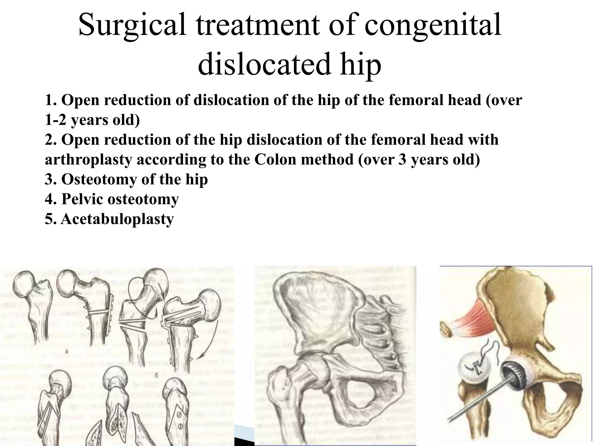 на английском вывих бедра лекция.ppt