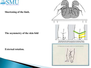 на английском вывих бедра лекция.ppt