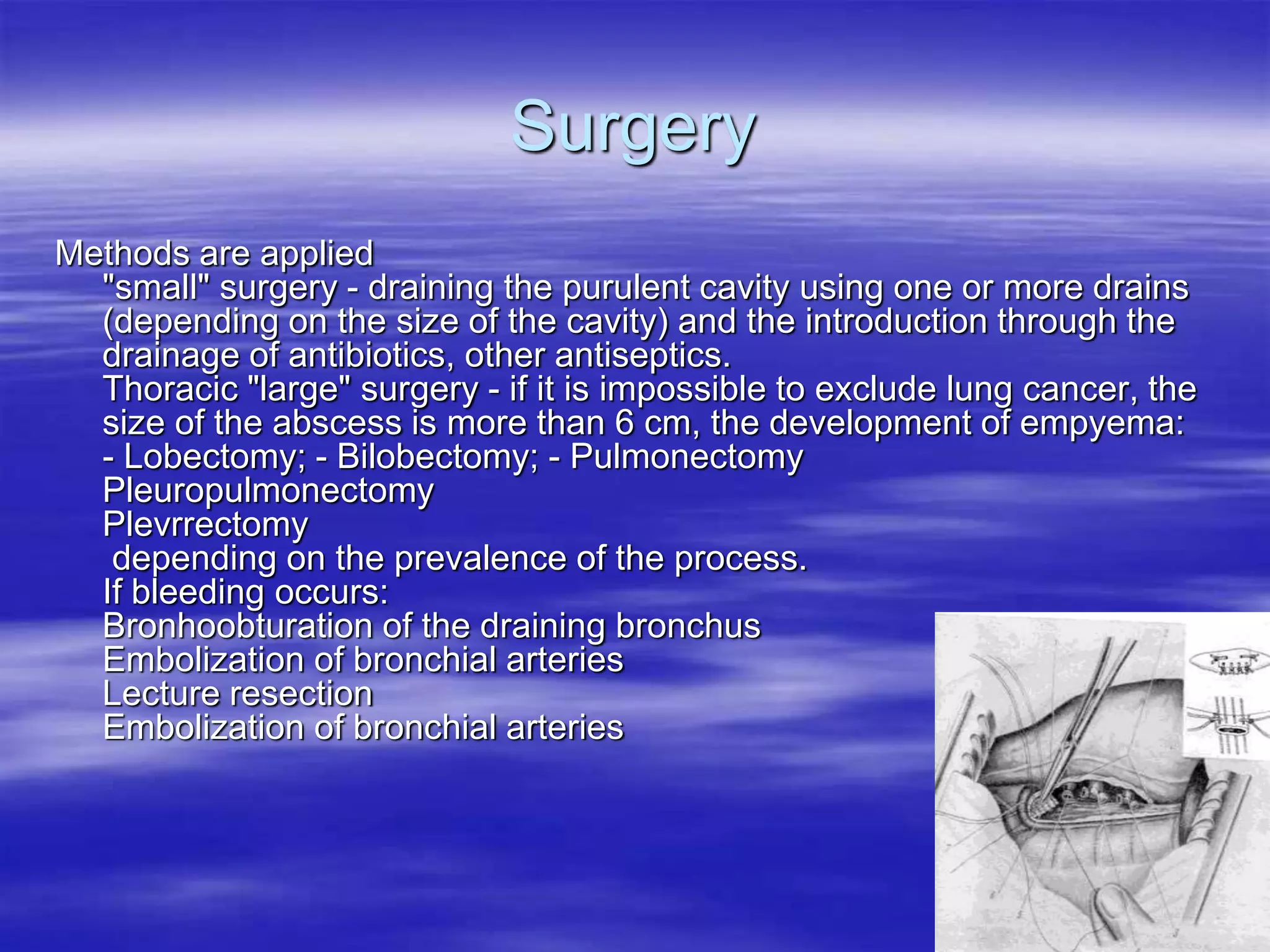 Лекция. Абсцесс и гангрена легких. Abscess, lung gangrene англ..ppt