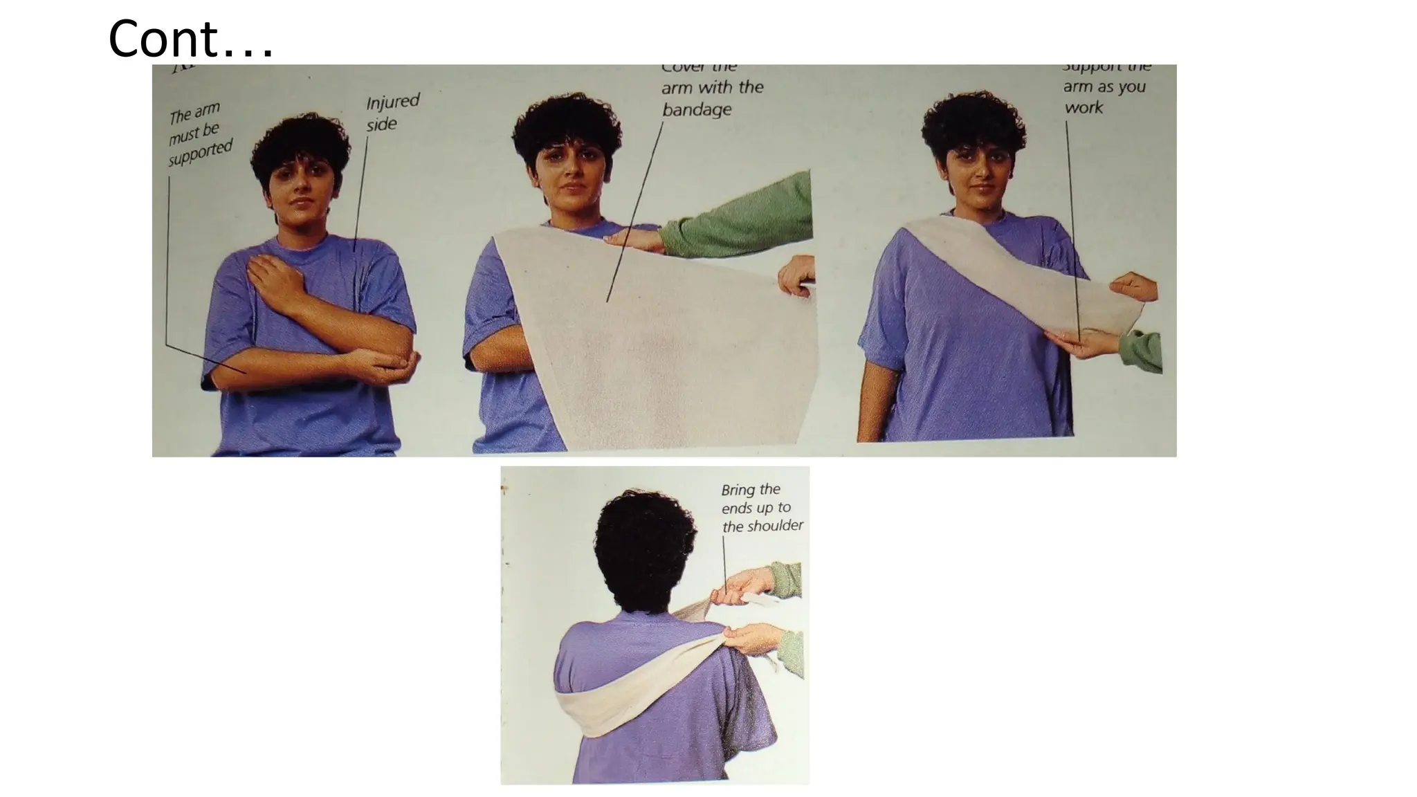 #. Bandaging and Splinting.pdf