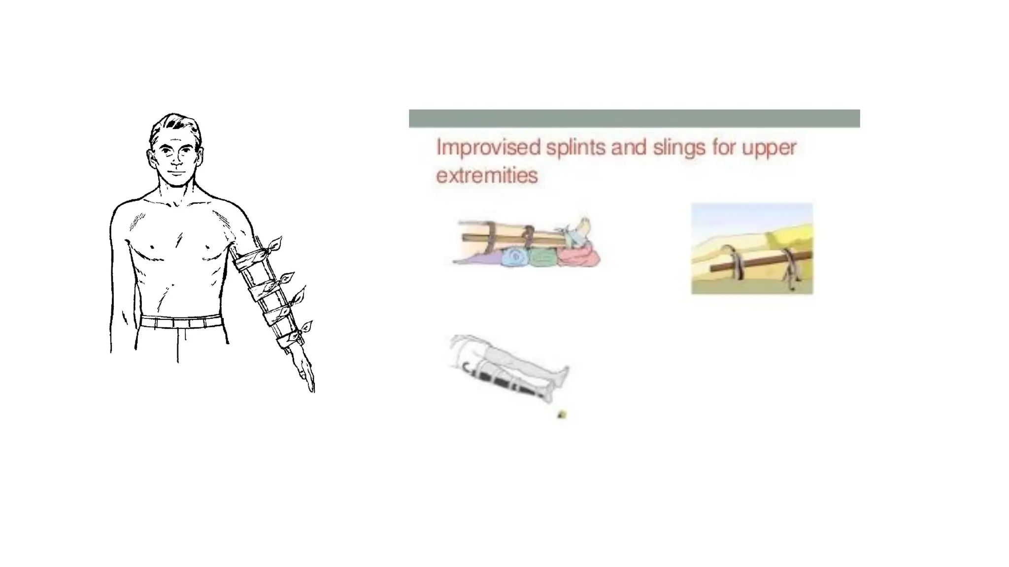 #. Bandaging and Splinting.pdf