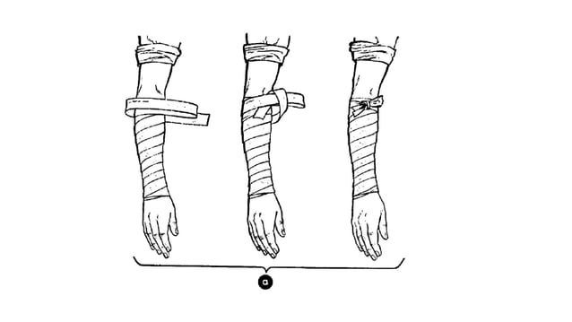 #. Bandaging and Splinting.pdf | First Aid | Injuries