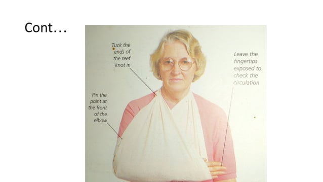#. Bandaging and Splinting.pdf | First Aid | Injuries