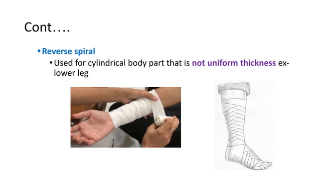#. Bandaging and Splinting.pdf | First Aid | Injuries