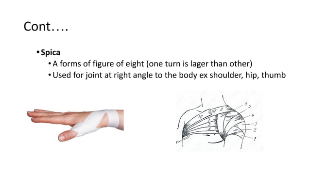 #. Bandaging and Splinting.pdf | First Aid | Injuries