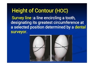 د.نغم Dental surveyor-1 (Muhadharaty).pdf