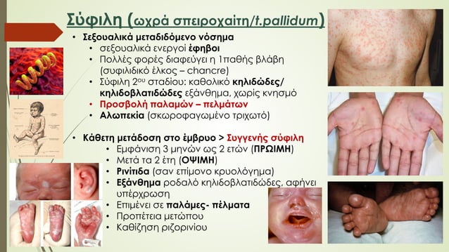 Συνεδρία Λοιμώξεων - Εξανθήματα στα Λοιμώδη Νοσήματα στα Παιδιά | PDF