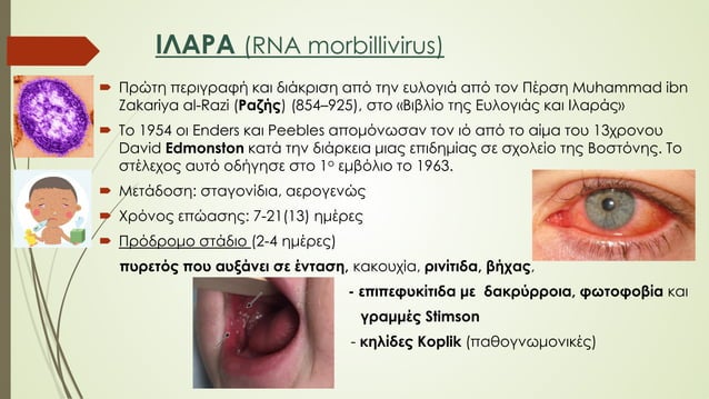 Συνεδρία Λοιμώξεων - Εξανθήματα στα Λοιμώδη Νοσήματα στα Παιδιά | PDF