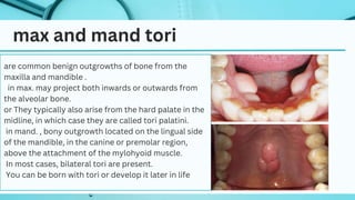 Tori palatinus , tori madibularis and treatment | PPTX