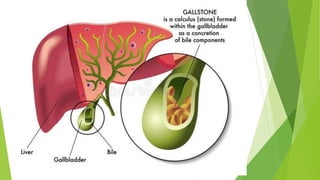 Yaraqn:causes, Classification and treatment | PPT | Free Download