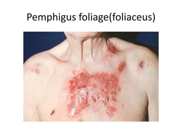 лекция.pptx for std dermatovenerology, cause and symptoms | PPT | Free ...