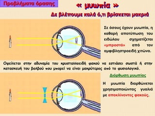 Μάτι, το όργανο της όρασης, τα μέρη του ματιού | PPT