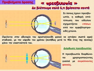 Μάτι, το όργανο της όρασης, τα μέρη του ματιού | PPT