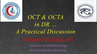 OCT and OCTA in DR practical discussions | PPT