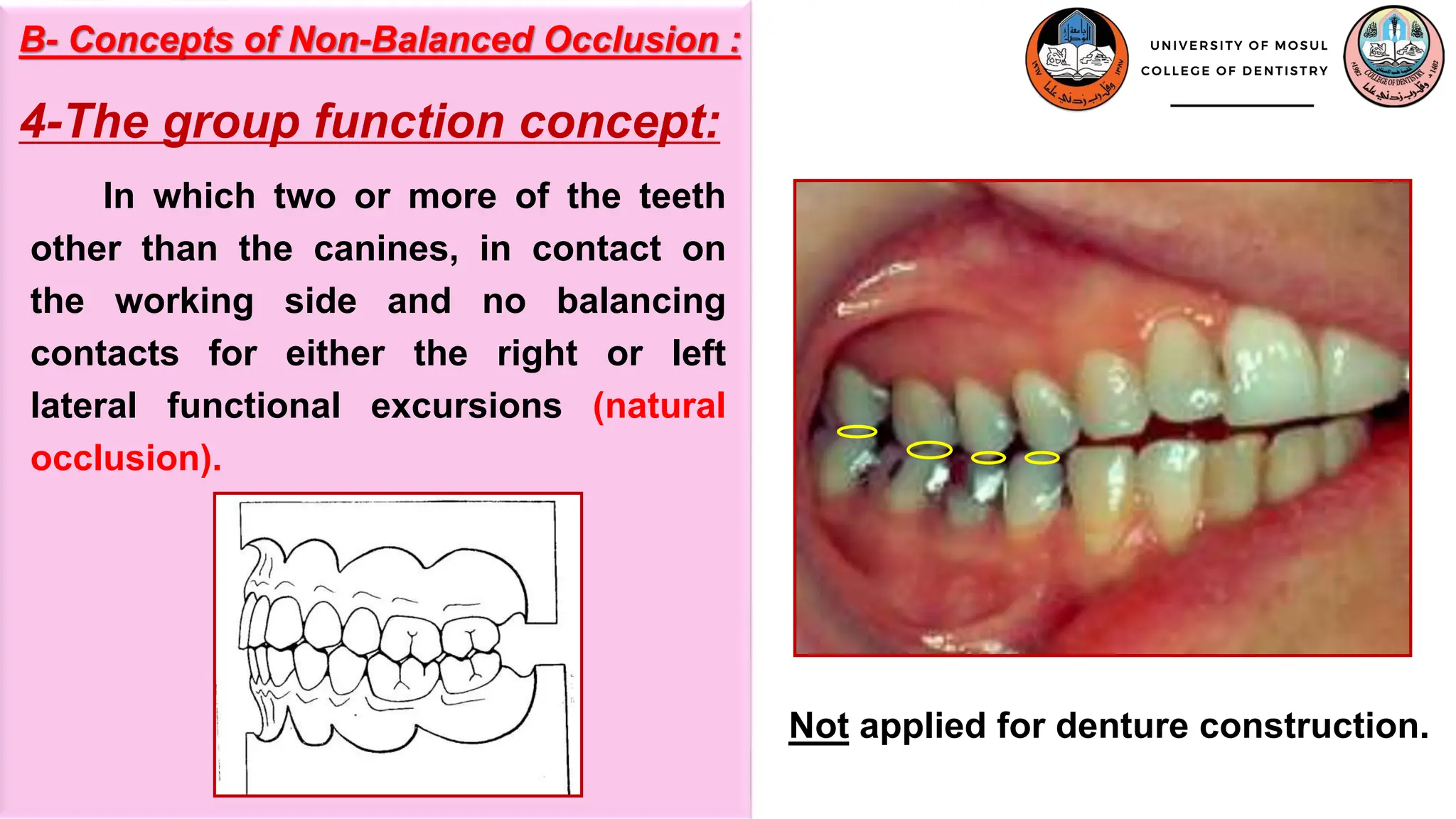 occlusion-5د منيه جامعه الدمنهوري .prosthodontic | PPT