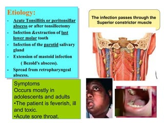 د.سعد published by The pharynx-9 (Muhadharaty).ppt