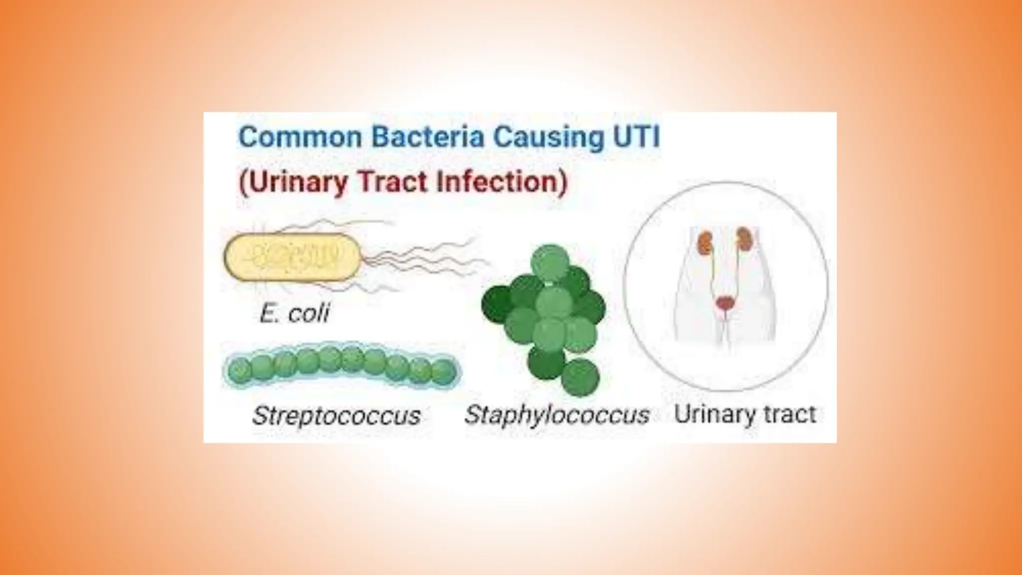 Prevention of Urinary tract infection pptx | PPT