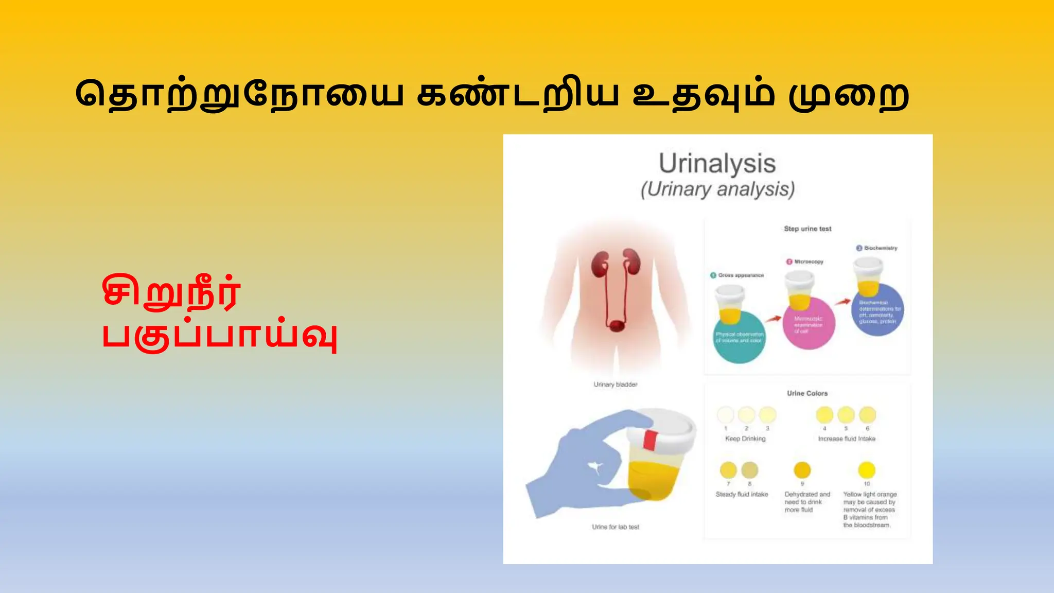 Prevention of Urinary tract infection pptx | PPT
