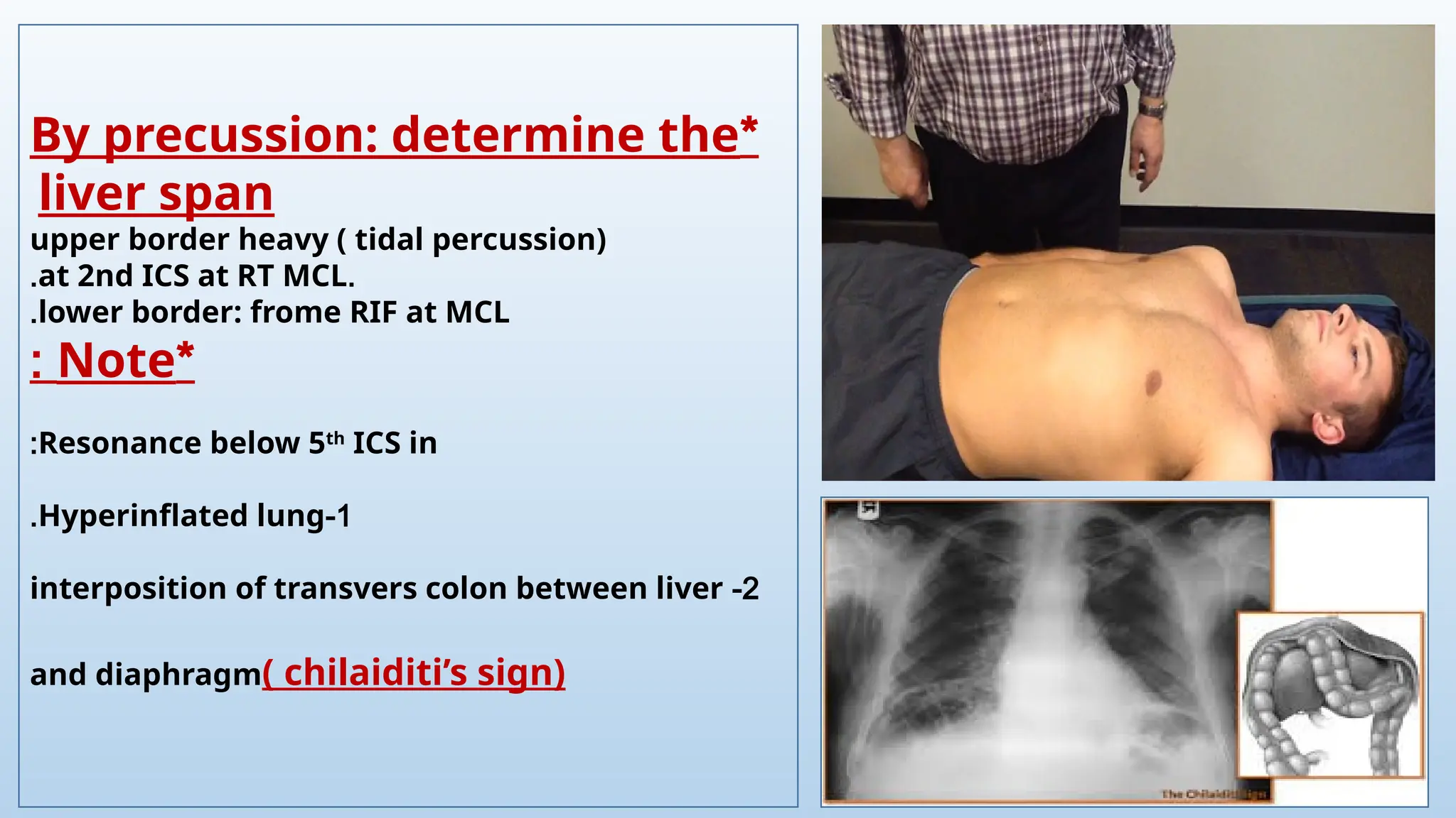 Persentation of the liver Hepatomegaly .pptx
