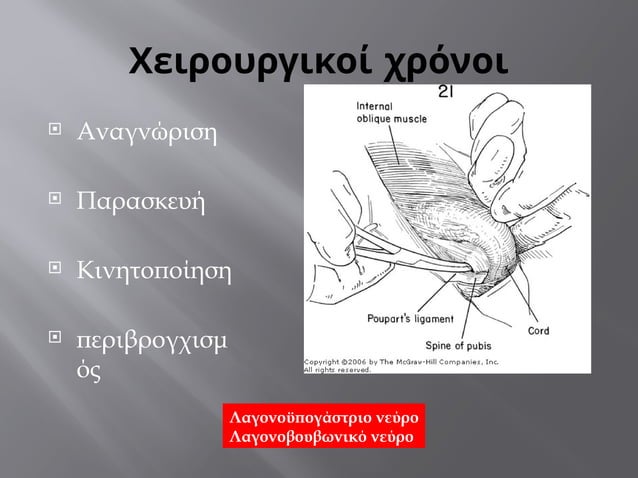 Operations for open Inguinal hernia surgery | PPT