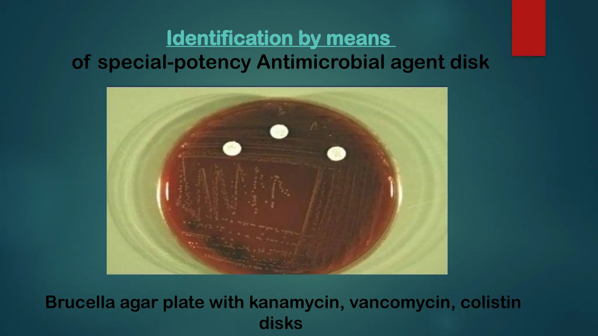 Gram-positive and negative anaerobic bacteria | PPT