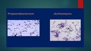 Gram-positive and negative anaerobic bacteria | PPT