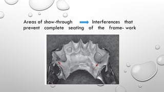vitallium Removable Partial Denture framework try in | PPTX