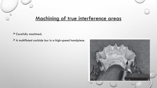 vitallium Removable Partial Denture framework try in | PPTX