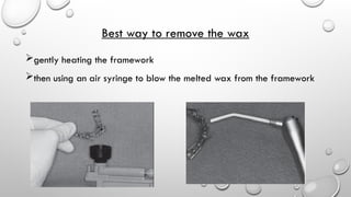 vitallium Removable Partial Denture framework try in | PPTX