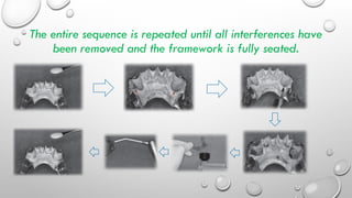 vitallium Removable Partial Denture framework try in | PPTX