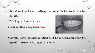 vitallium Removable Partial Denture framework try in | PPTX