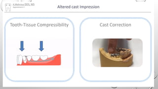 vitallium Removable Partial Denture framework try in | PPTX