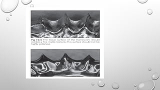 vitallium Removable Partial Denture framework try in | PPT