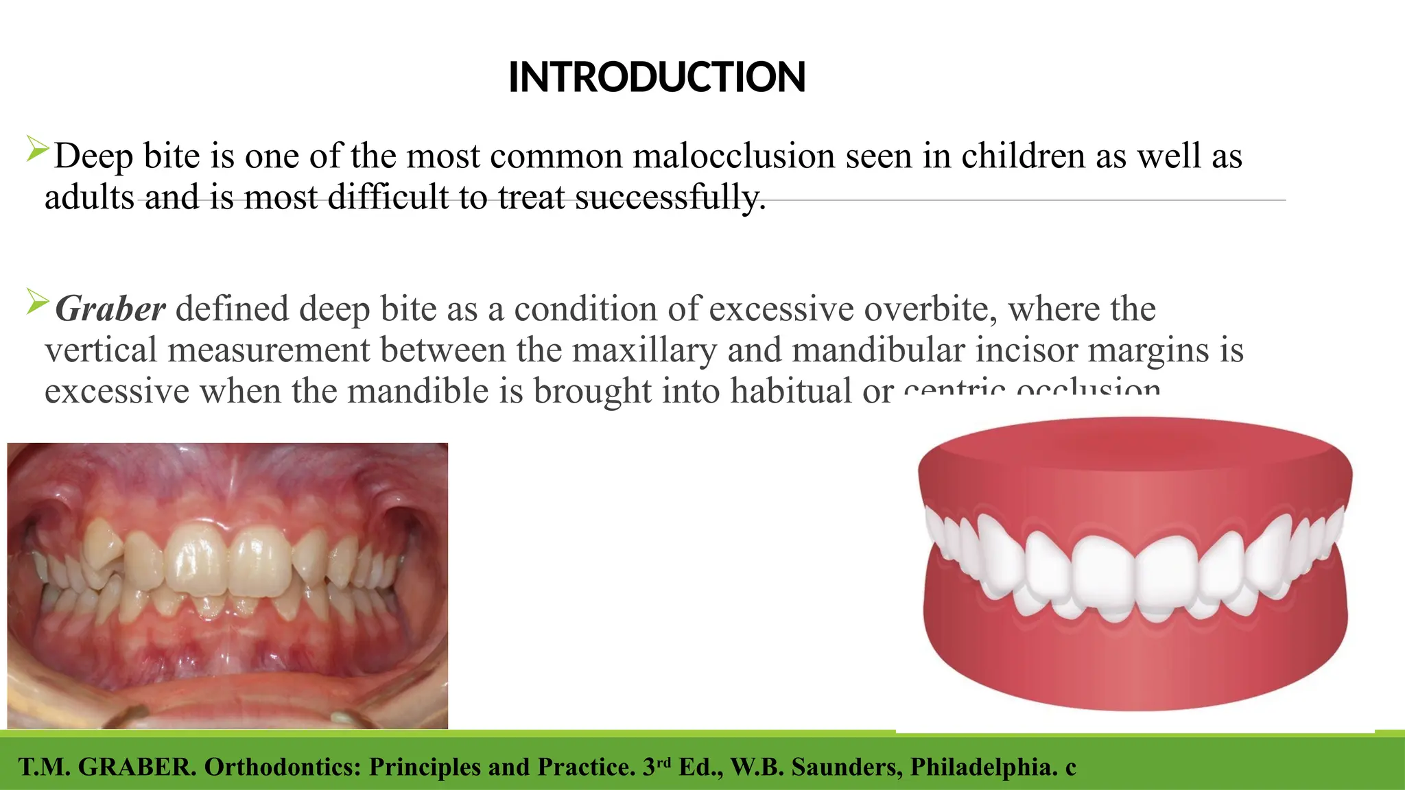 Deep bite - Classification Treatment modalities.pptx