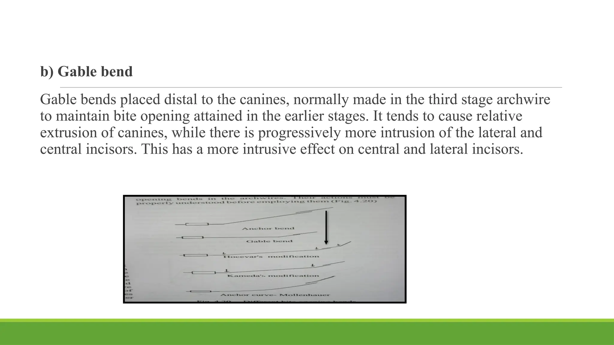 deep bite - treatment modality Copy.pptx