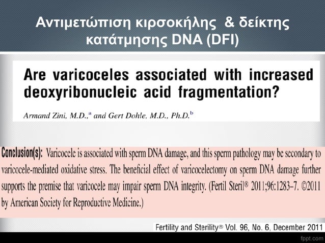 current surgical treatments of varicocele | PPTX