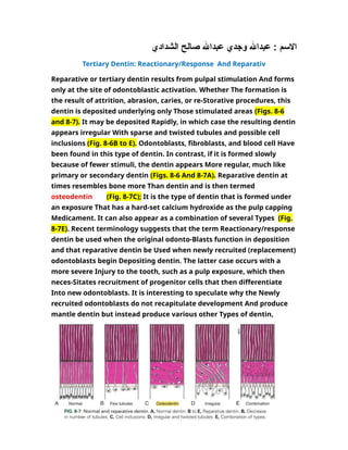 Tertiary Dentin: Reactionary/Response and Reparativ | DOCX