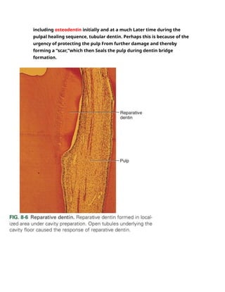 Tertiary Dentin: Reactionary/Response and Reparativ | DOCX
