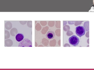 骨髓细胞形态学检查.pdf (Bone marrow cell morphology examination)) | PDF