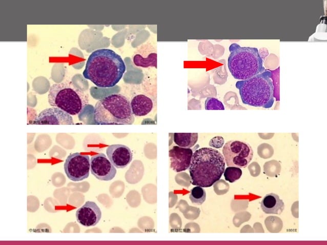 骨髓细胞形态学检查.pdf (Bone marrow cell morphology examination)) | PPT