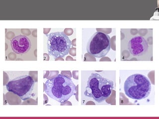 骨髓细胞形态学检查.pdf (Bone marrow cell morphology examination)) | PDF
