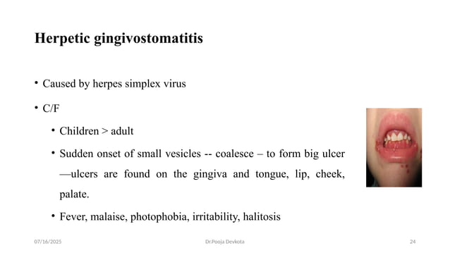 .normal and disease gums.pptx types,causes | PPTX
