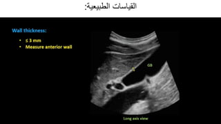 gallbladder anatomy and by Echo arabic version | PDF