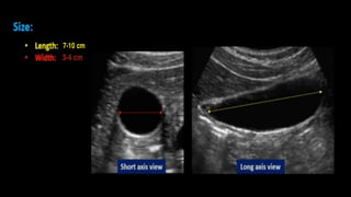 gallbladder anatomy and by Echo arabic version | PDF