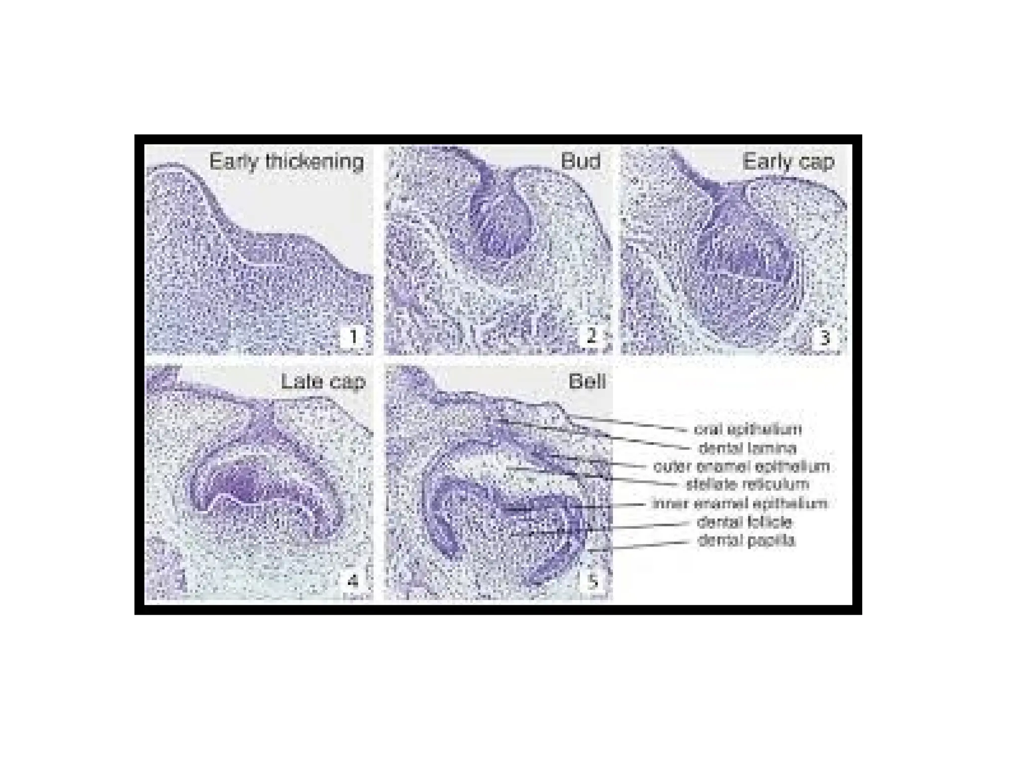 Odontogenic cysts Types histopathology and treatment part 2 | PPTX