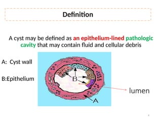 Odontogenic cysts Types histopathology and treatment part 2 | PPTX