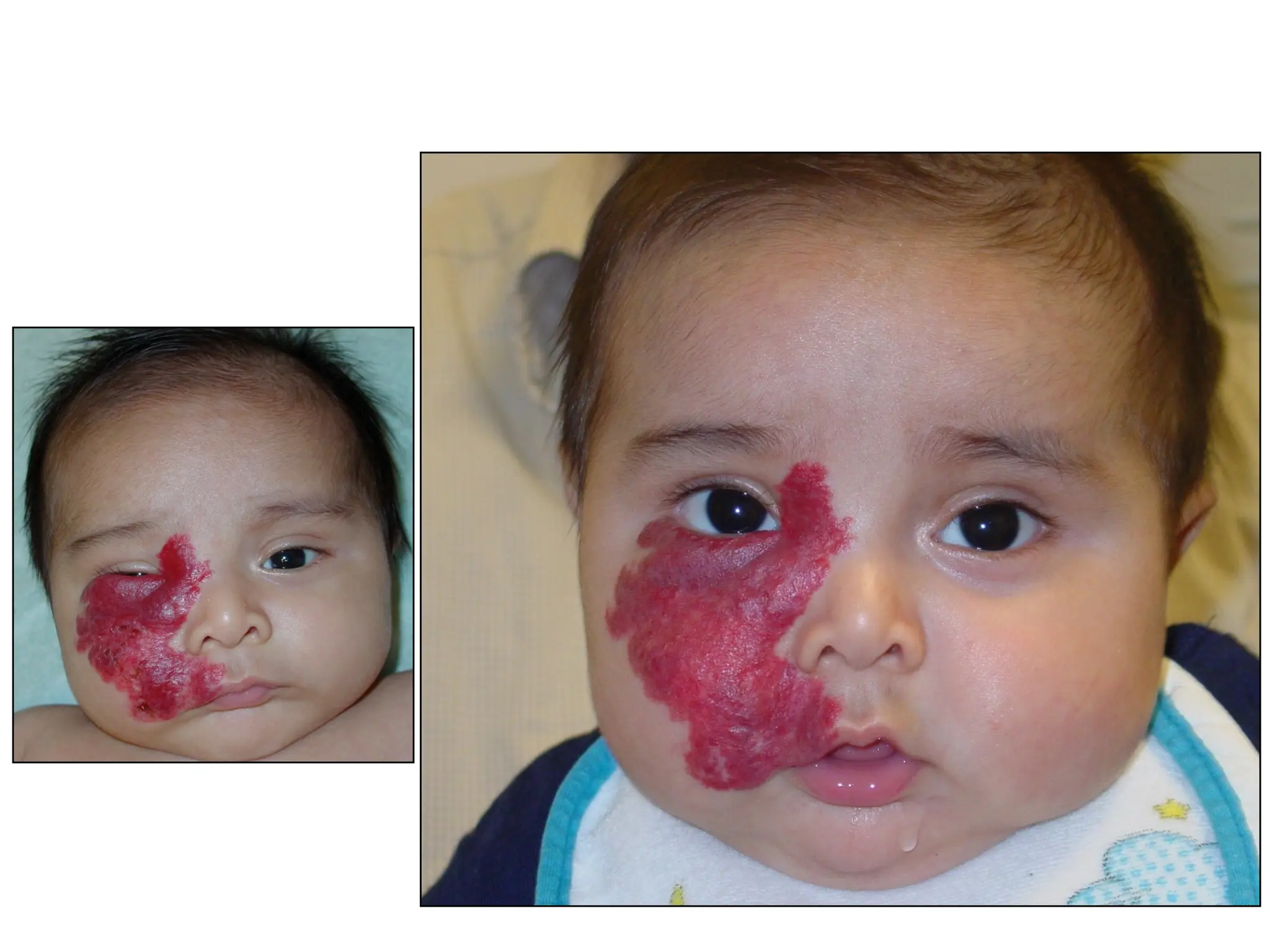 د.برع extraction-5 (Muhadharaty).pptx 55 | PPTX