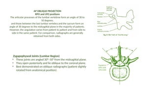 x-ray projection of spine . notes that might be useful .pptx
