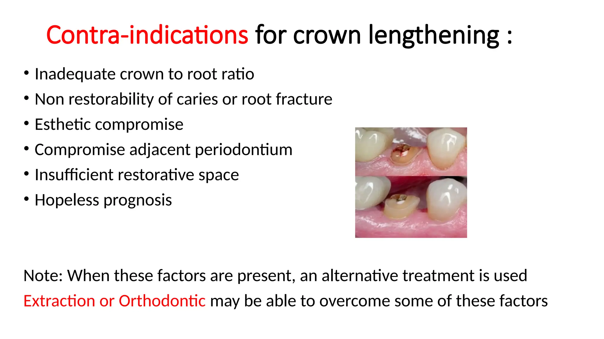 Esthetic crow lengthening surgery تطويل التيجان جراحيا.pptx